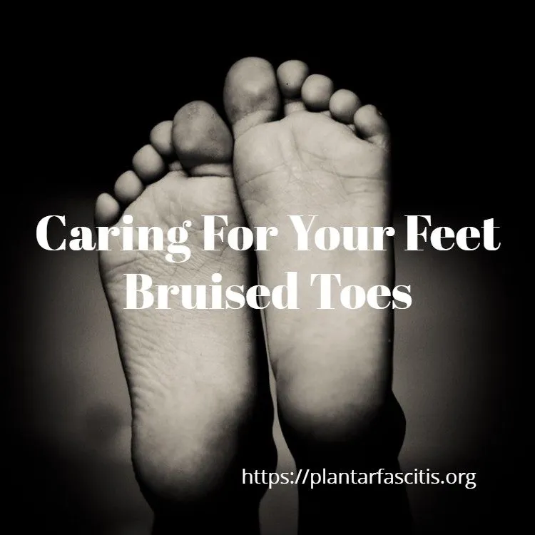 Caring For Your Feet - Bruised Toes