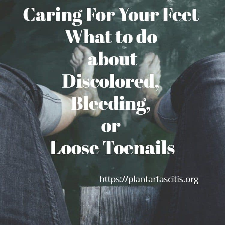 How to Wrap Foot For Plantar Fasciitis With ACE Bandage